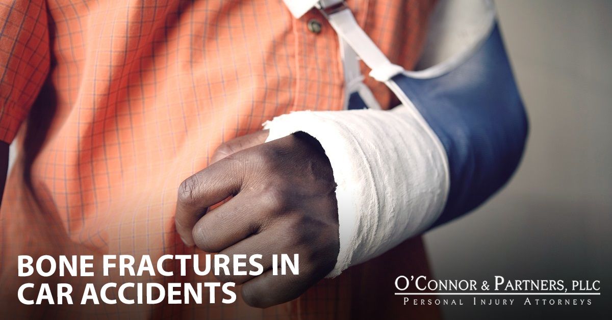 Bone Fracture in New York Car Accidents | O'Connor & Partners