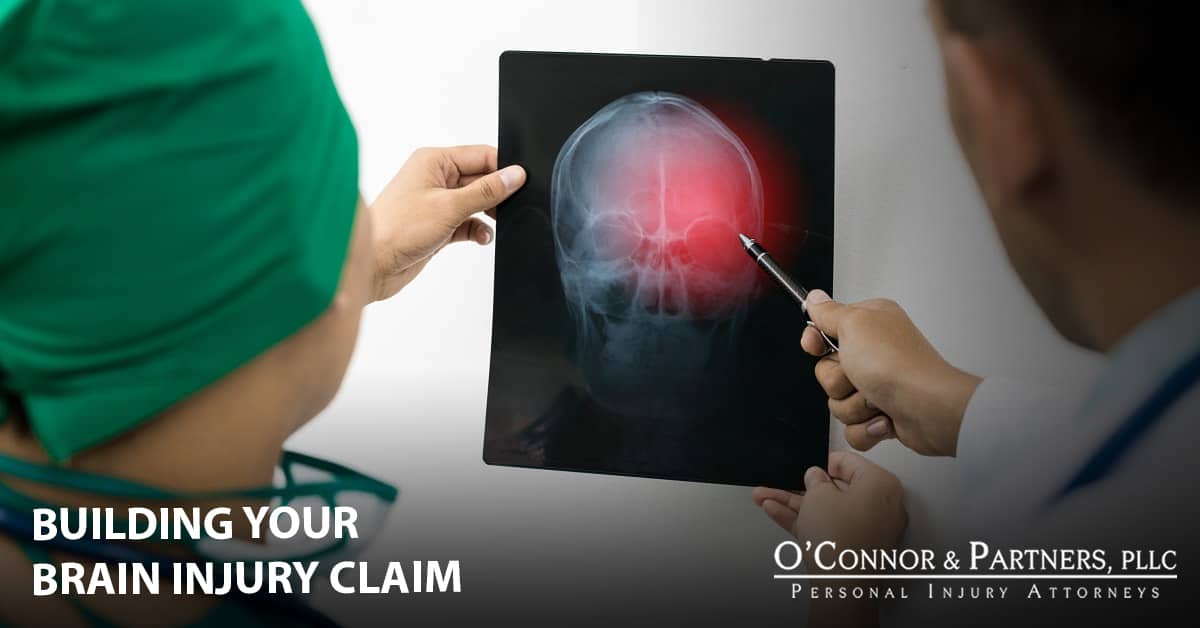 How Do I Build a Case for a Brain Injury? | O'Connor & Partners